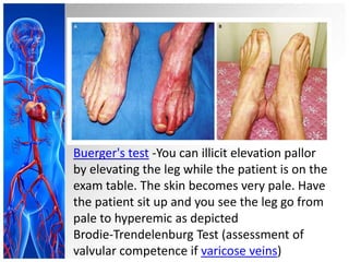 Periphral Arterial Disease | PPTX | Diabetes | Diseases and Conditions