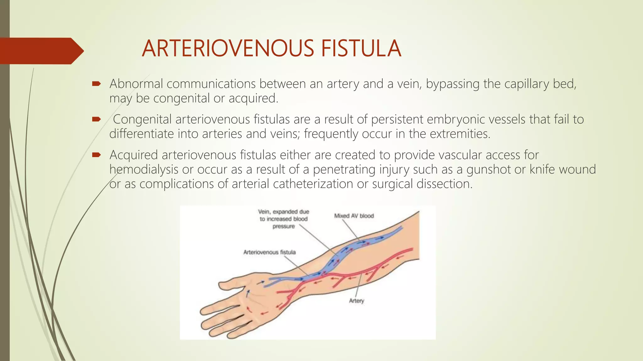 Peripheral artery disease | PPTX