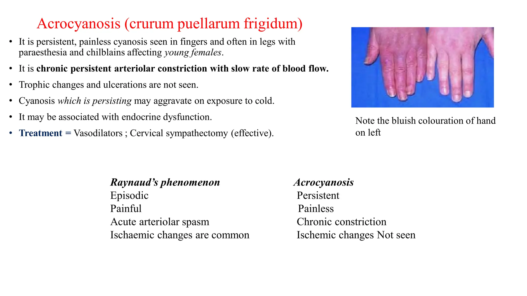 Seminar on Peripheral artery diseases.pdf