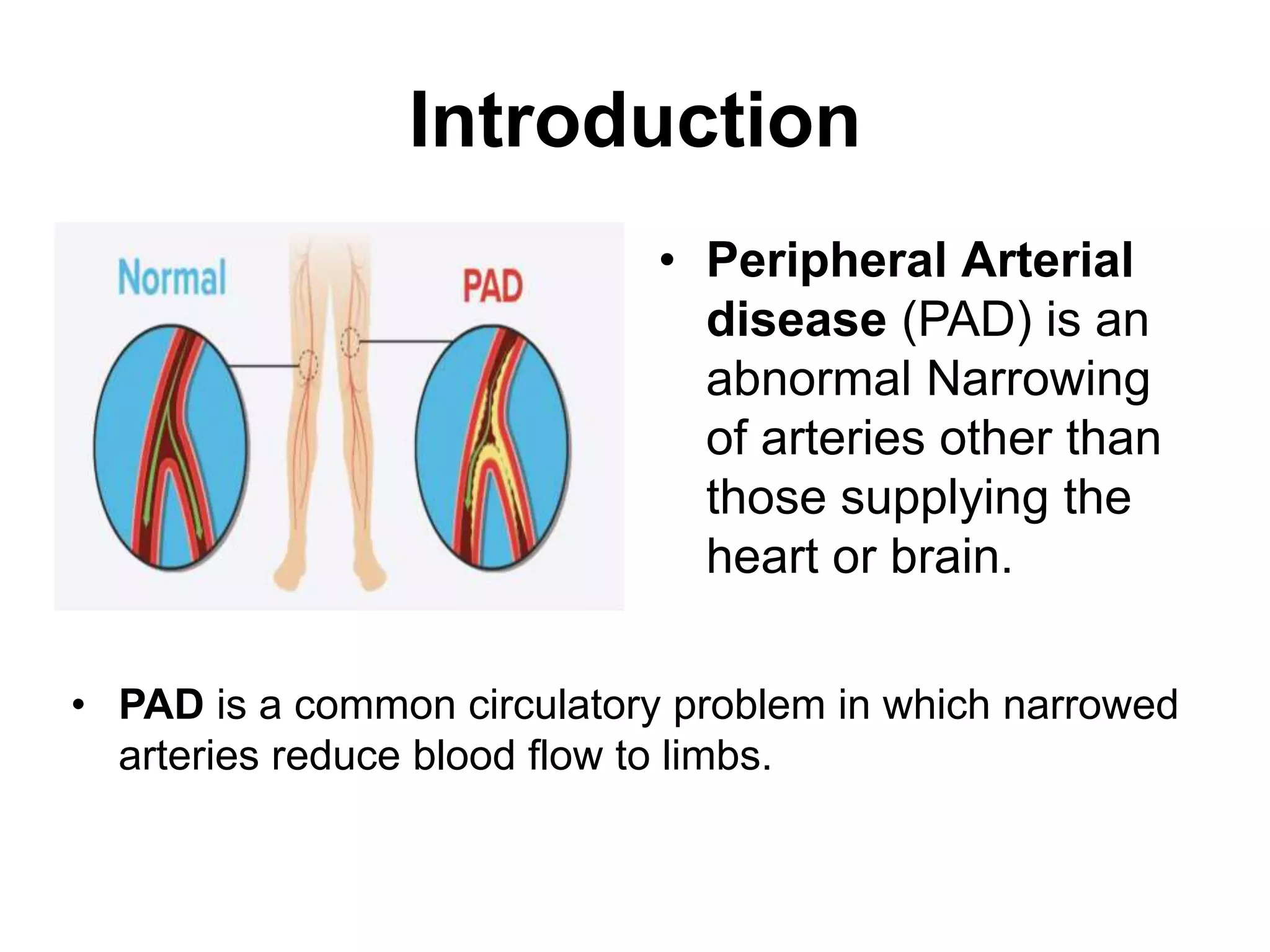 Peripheral artery disease | PPTX