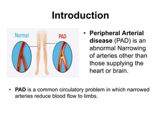 Peripheral artery disease | PPTX