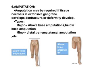 Peripheral artery disease | PPTX