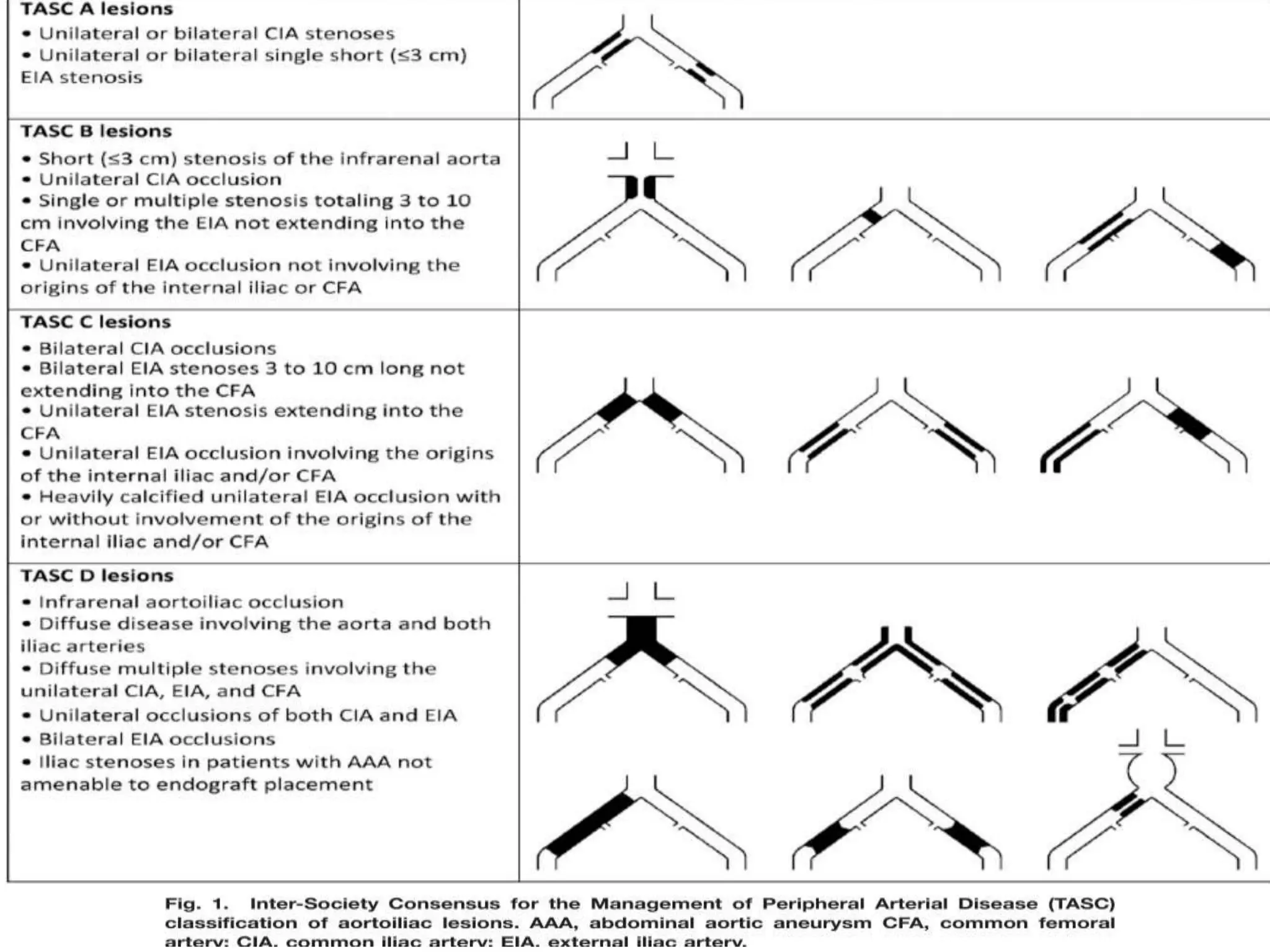 PAD & Lower Extremity Interventions | PPTX