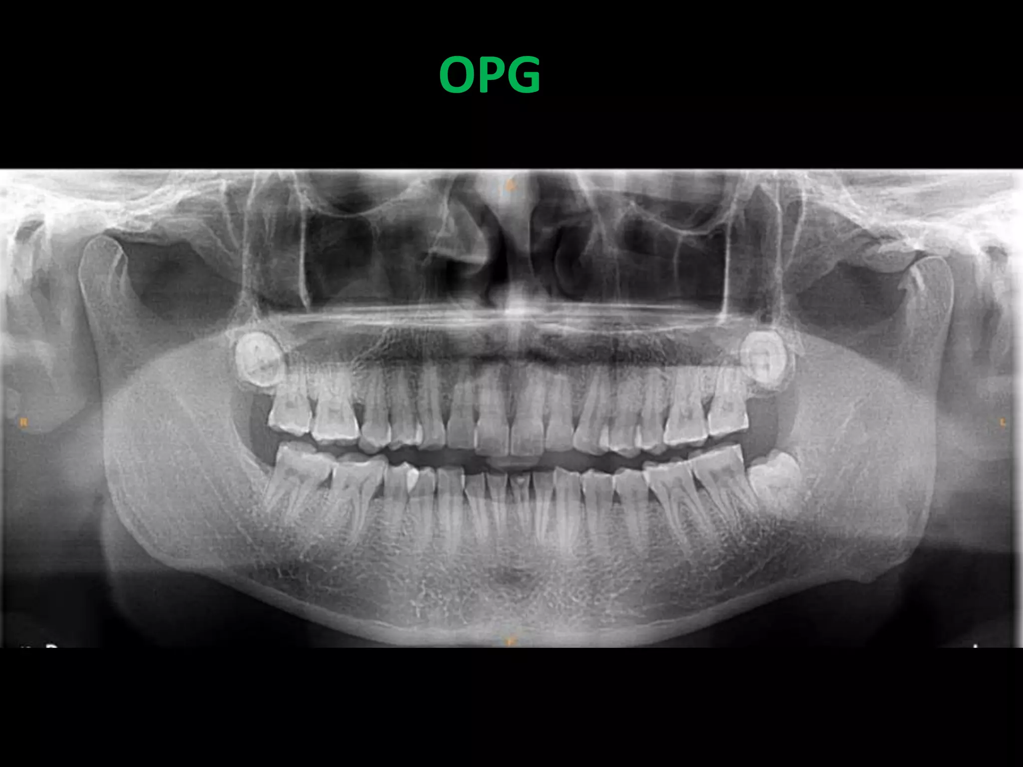 DAHL'S PRINCIPLE | PPT