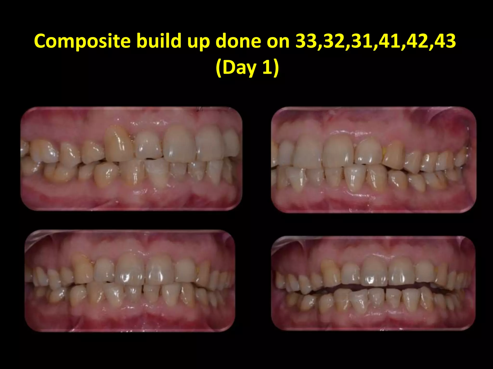 DAHL'S PRINCIPLE | PPT