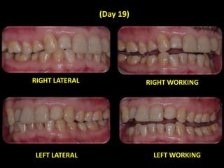 DAHL'S PRINCIPLE | PPT | Free Download