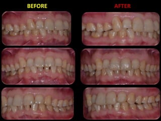 DAHL'S PRINCIPLE | PPT