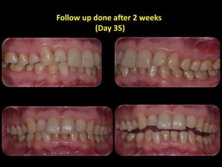 DAHL'S PRINCIPLE | PPT