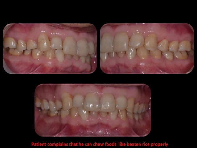 DAHL'S PRINCIPLE | PPT