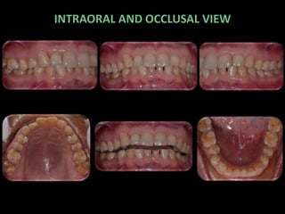 DAHL'S PRINCIPLE | PPT | Free Download