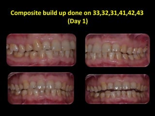 DAHL'S PRINCIPLE | PPT | Free Download