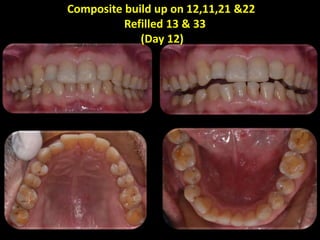 DAHL'S PRINCIPLE | PPTX