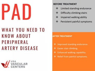 Pad Treatment: Before and After Transformation | PPT