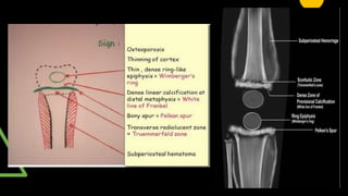 paed high yield git, scurvy , rickets radiology | PPTX