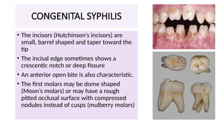 ORAL MANIFESTATION OF SYSTEMIC DISEASE.pptx