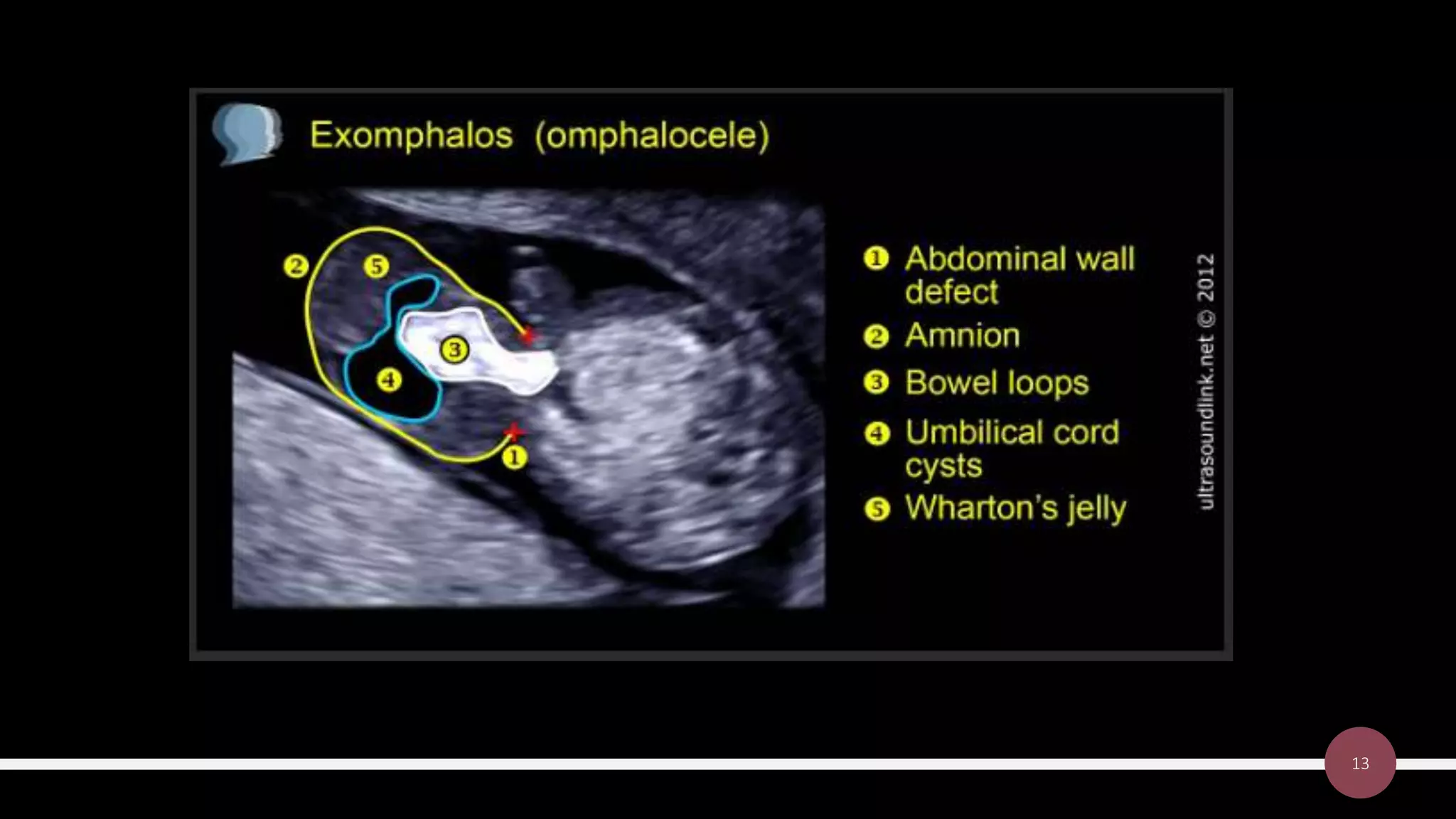 Paediatric Abdominal Imaging ( Grainger and Allison diagnostic ...