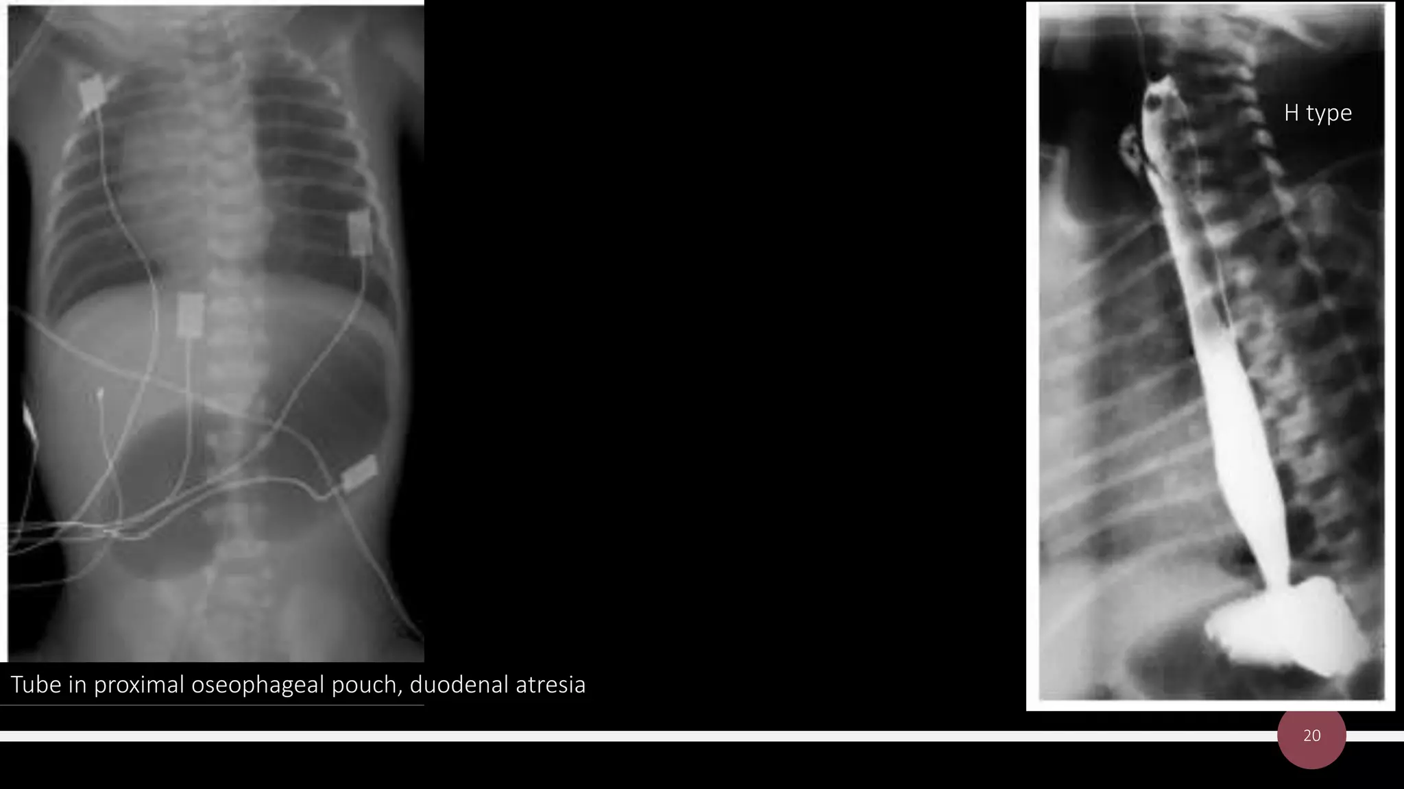 Paediatric Abdominal Imaging ( Grainger and Allison diagnostic ...