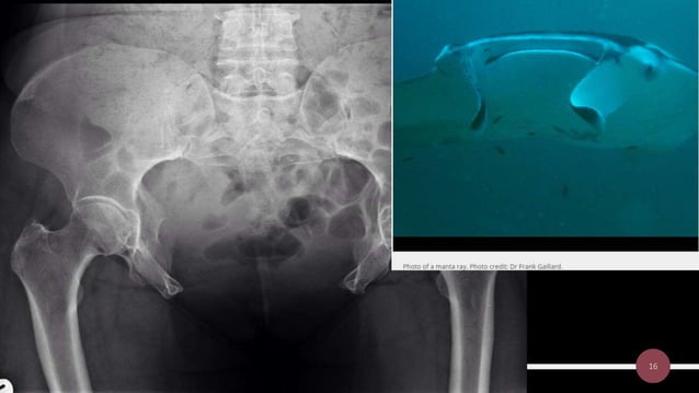 Paediatric Abdominal Imaging ( Grainger and Allison diagnostic ...