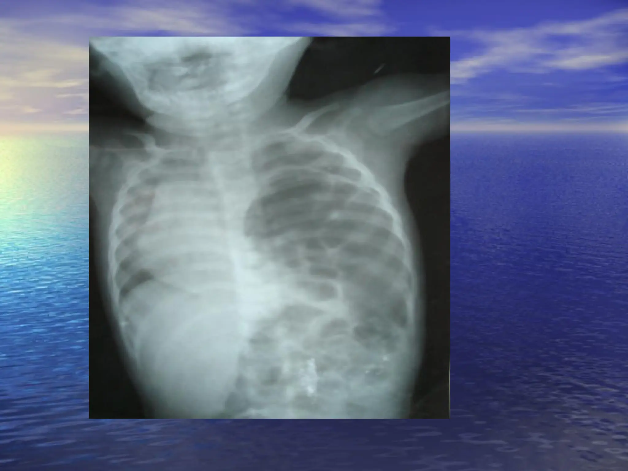 Paediatrics-Chest-radiology spotters.ppt