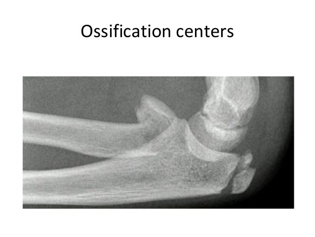 paediatric elbow fractures