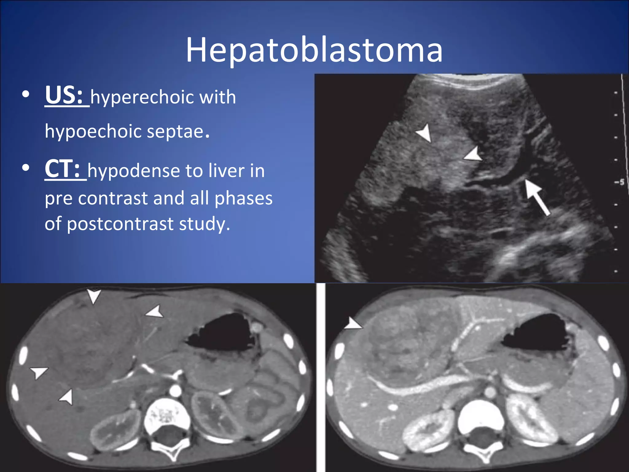 Pediatric GIT Imaging | PPT