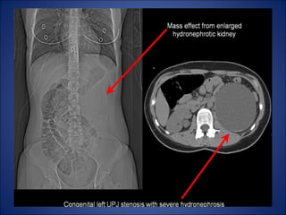 Pediatric GIT Imaging | PPT