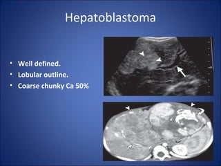 Pediatric GIT Imaging | PPT