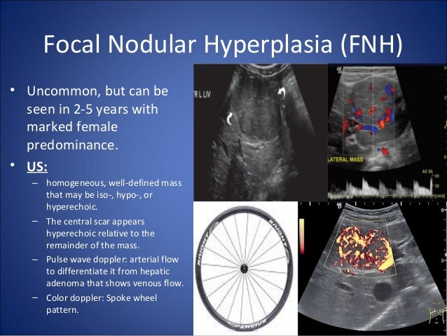 Pediatric GIT Imaging