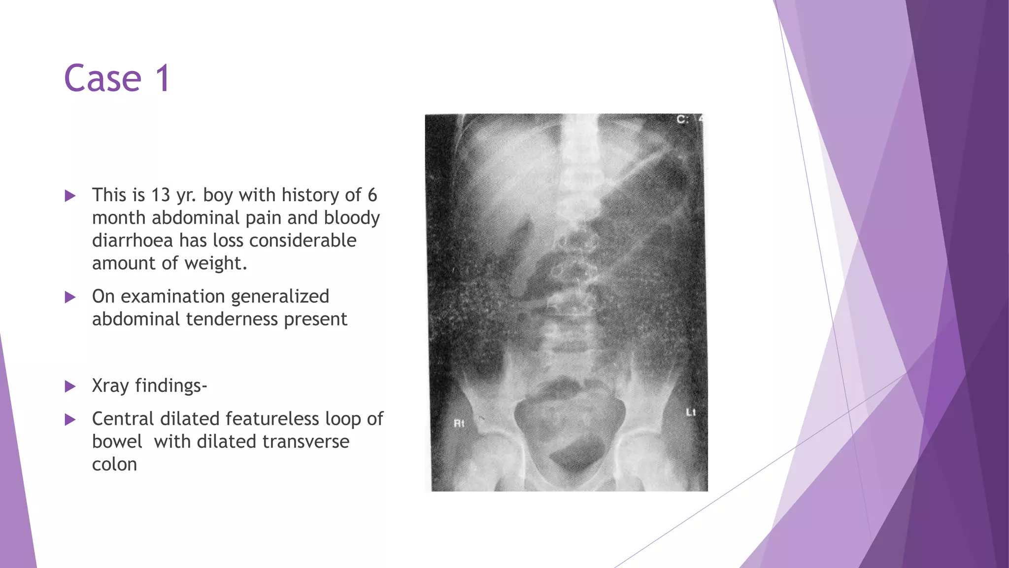 Paediatric abdominal x-ray-A key to diagnosis.pptx