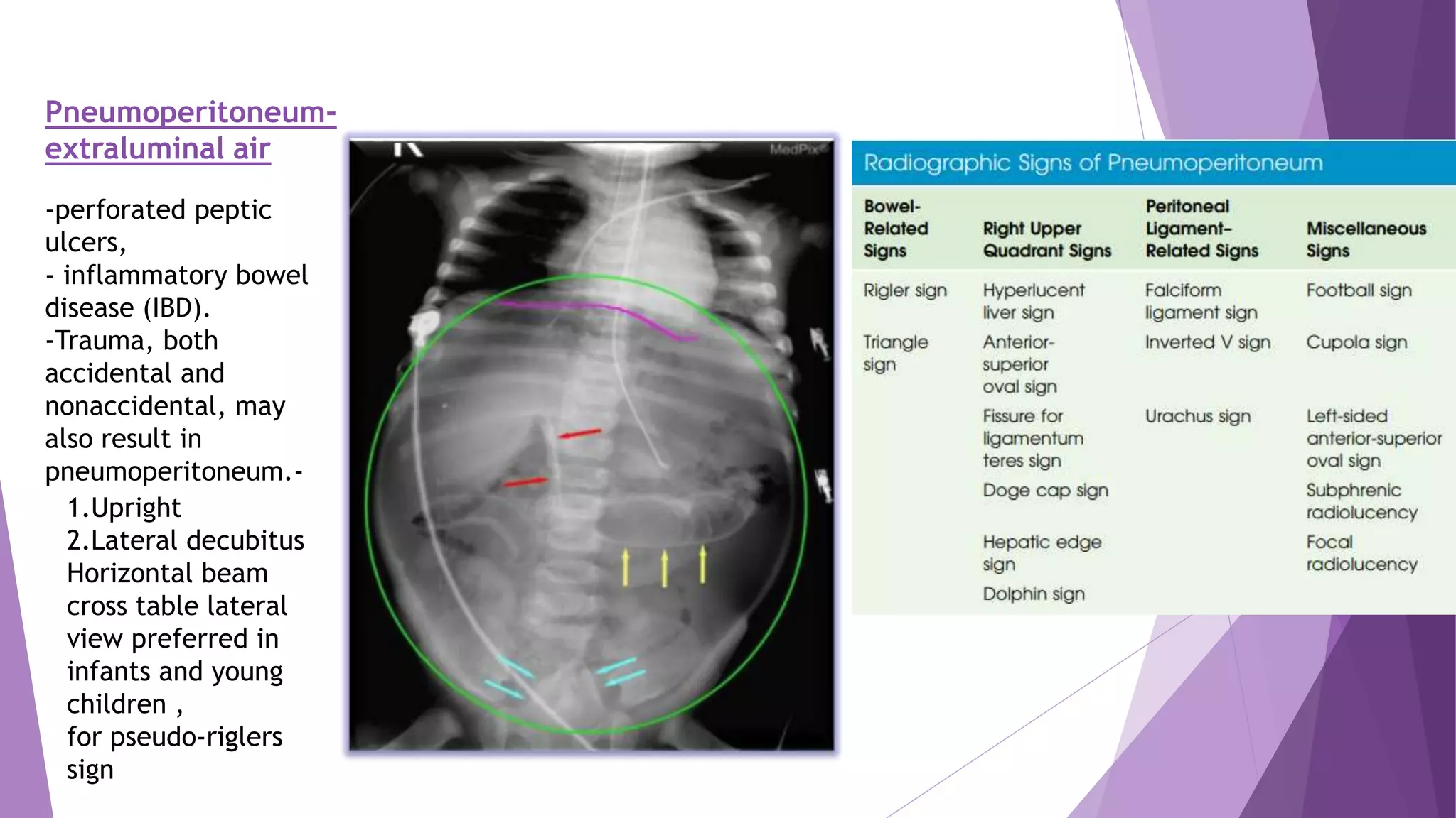 Paediatric abdominal x-ray-A key to diagnosis.pptx