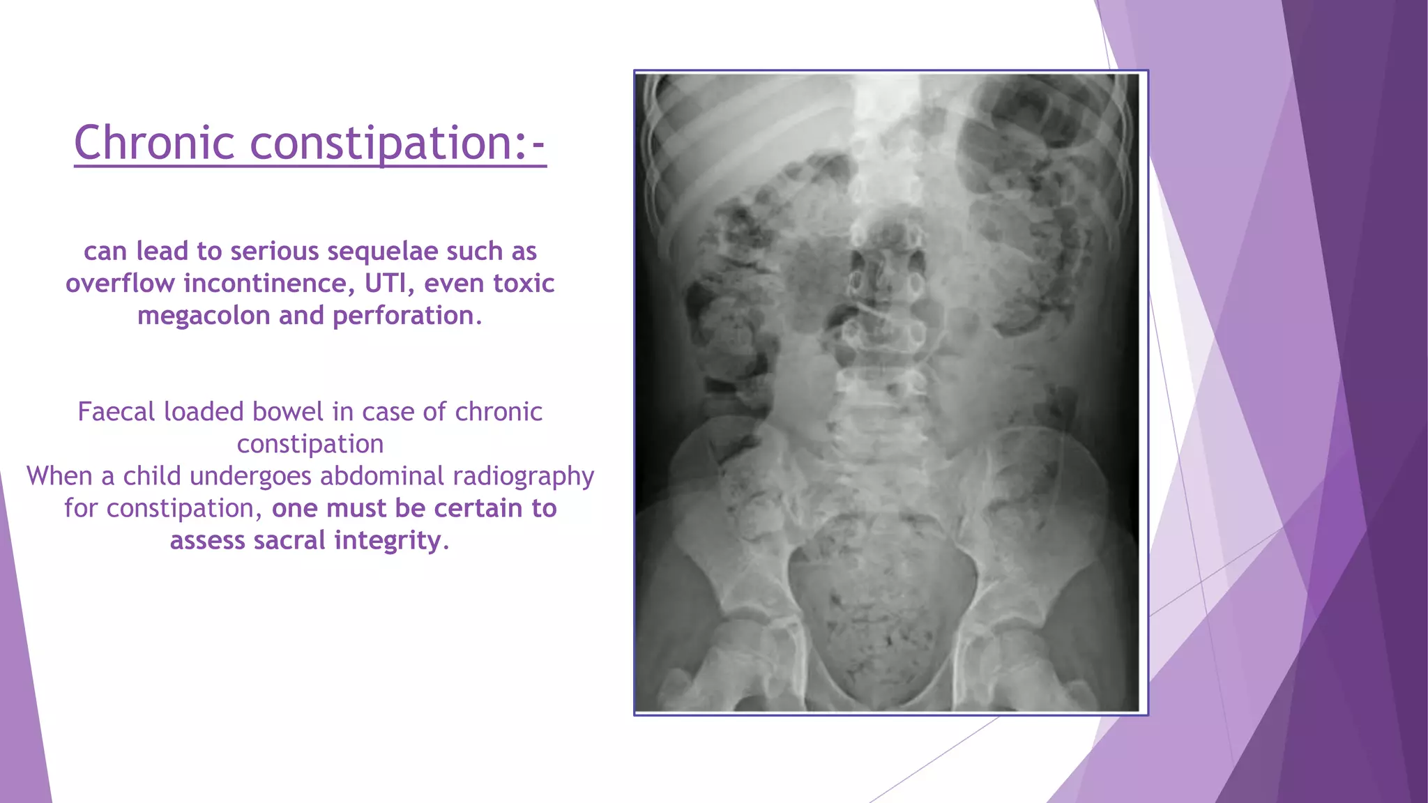 Paediatric abdominal x-ray-A key to diagnosis.pptx