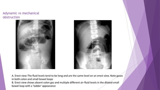 Paediatric abdominal x-ray-A key to diagnosis.pptx