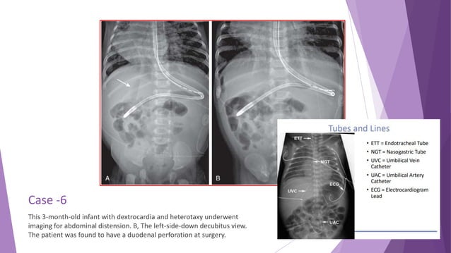 Paediatric abdominal x-ray-A key to diagnosis.pptx
