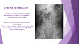 Paediatric abdominal x-ray-A key to diagnosis.pptx