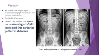 Paediatric abdominal x-ray-A key to diagnosis.pptx