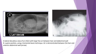 Paediatric abdominal x-ray-A key to diagnosis.pptx