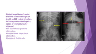 Paediatric abdominal x-ray-A key to diagnosis.pptx