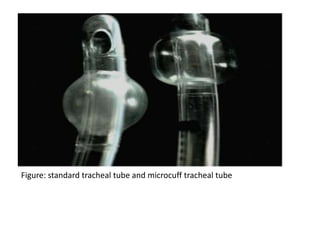 Paediatric anatomy and physiology for Anaesthesia | PPTX