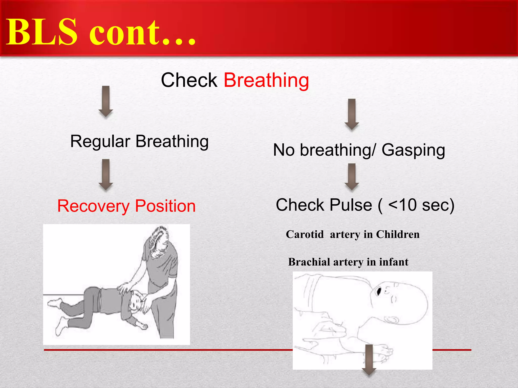 Paediatric basic life support ppt | PPTX