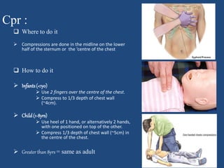 Paediatric bls | PPTX