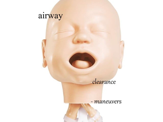 Paediatric bls | PPTX | First Aid | Injuries