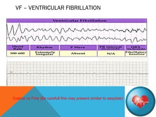 Paediatric bls and choking algorithm | PPT