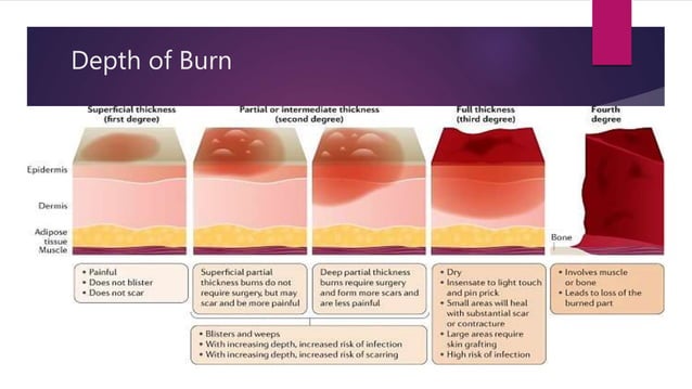 Paediatric burn management | PPTX