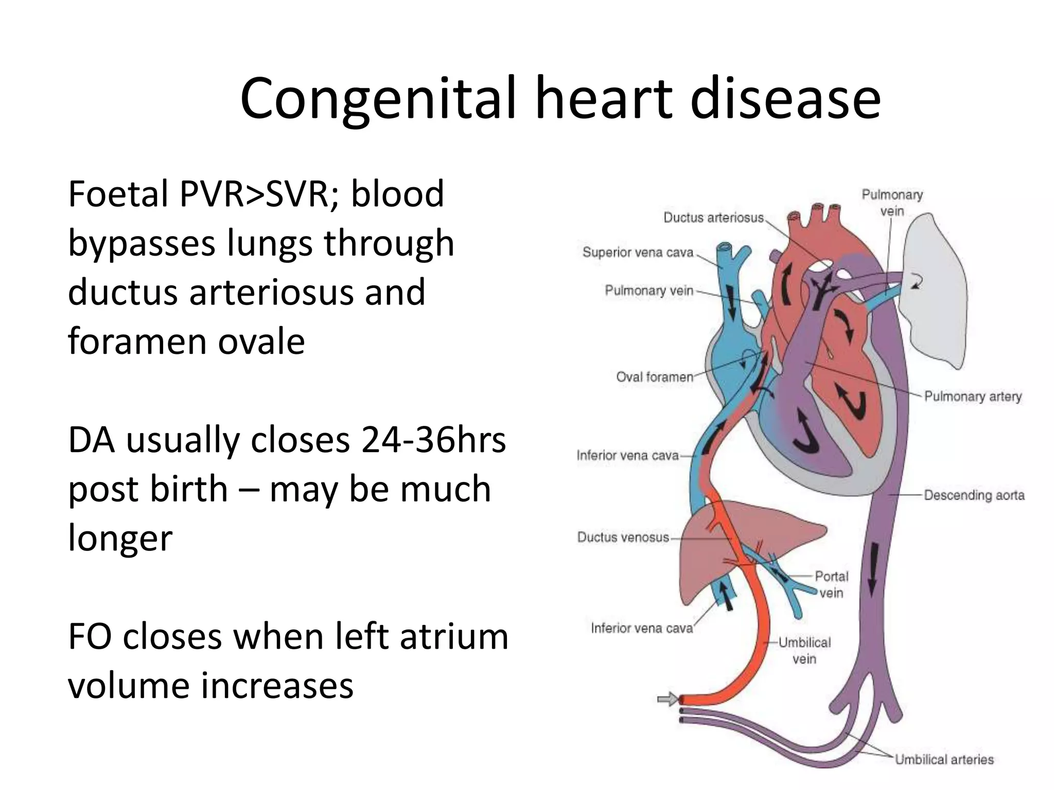 paediatric_cardiology3.ppt