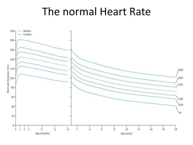 paediatric_cardiology3.ppt