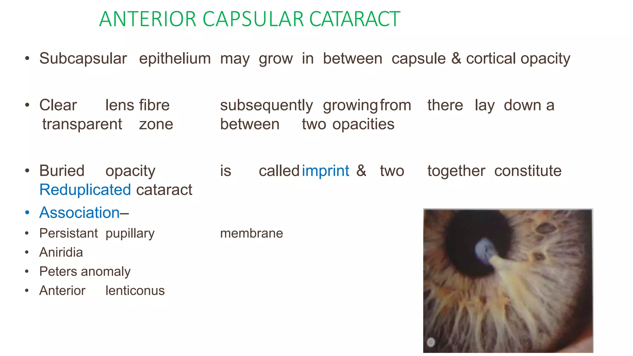 Paediatric cataract -DR ARNAV SAROYA | PPT