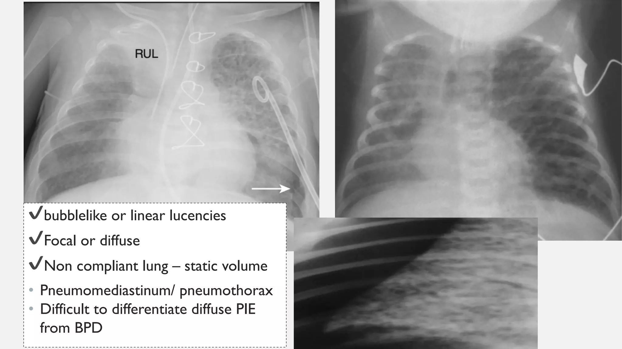Paediatric chest 031220 | PDF