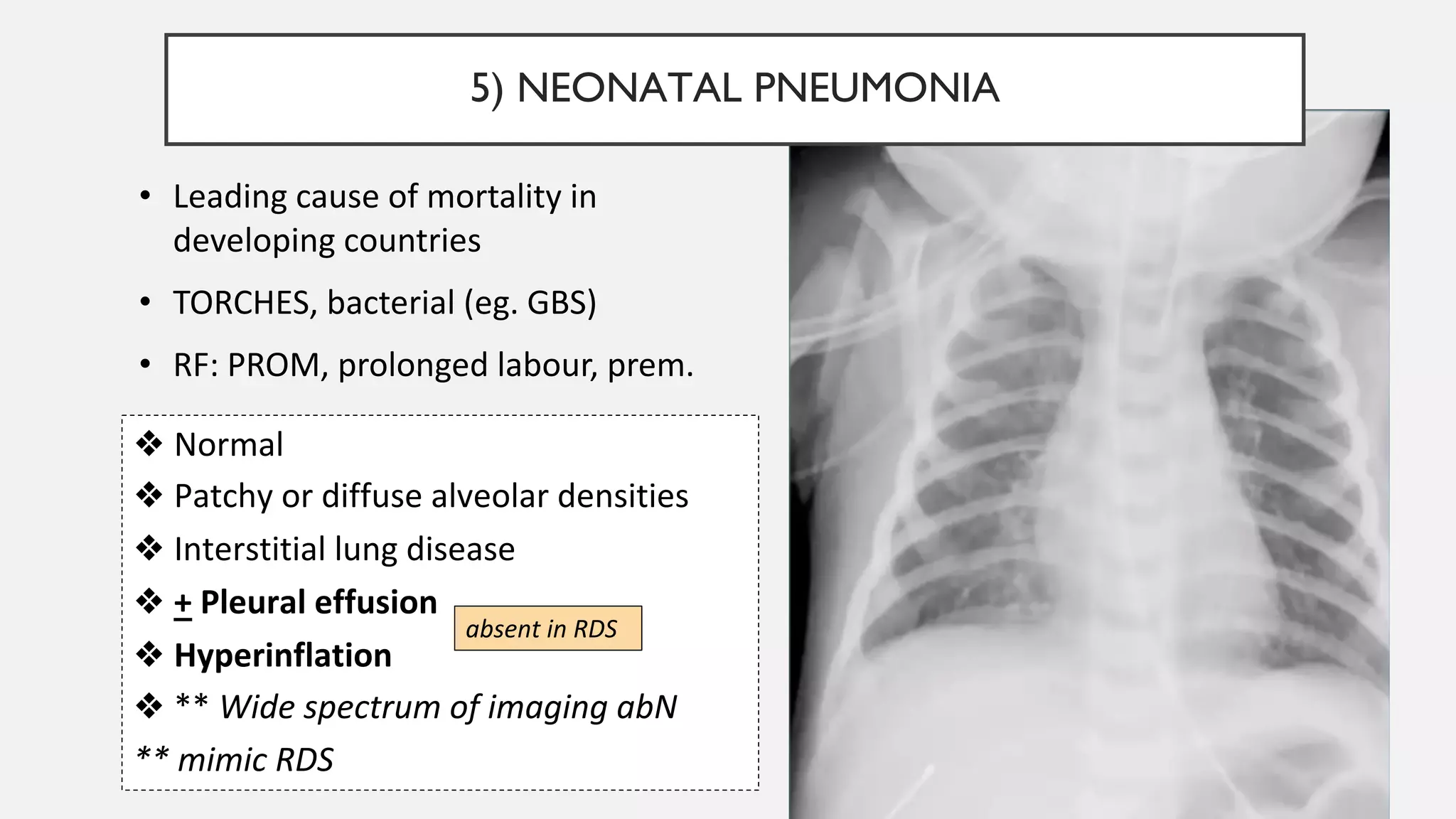 Paediatric chest 031220 | PDF