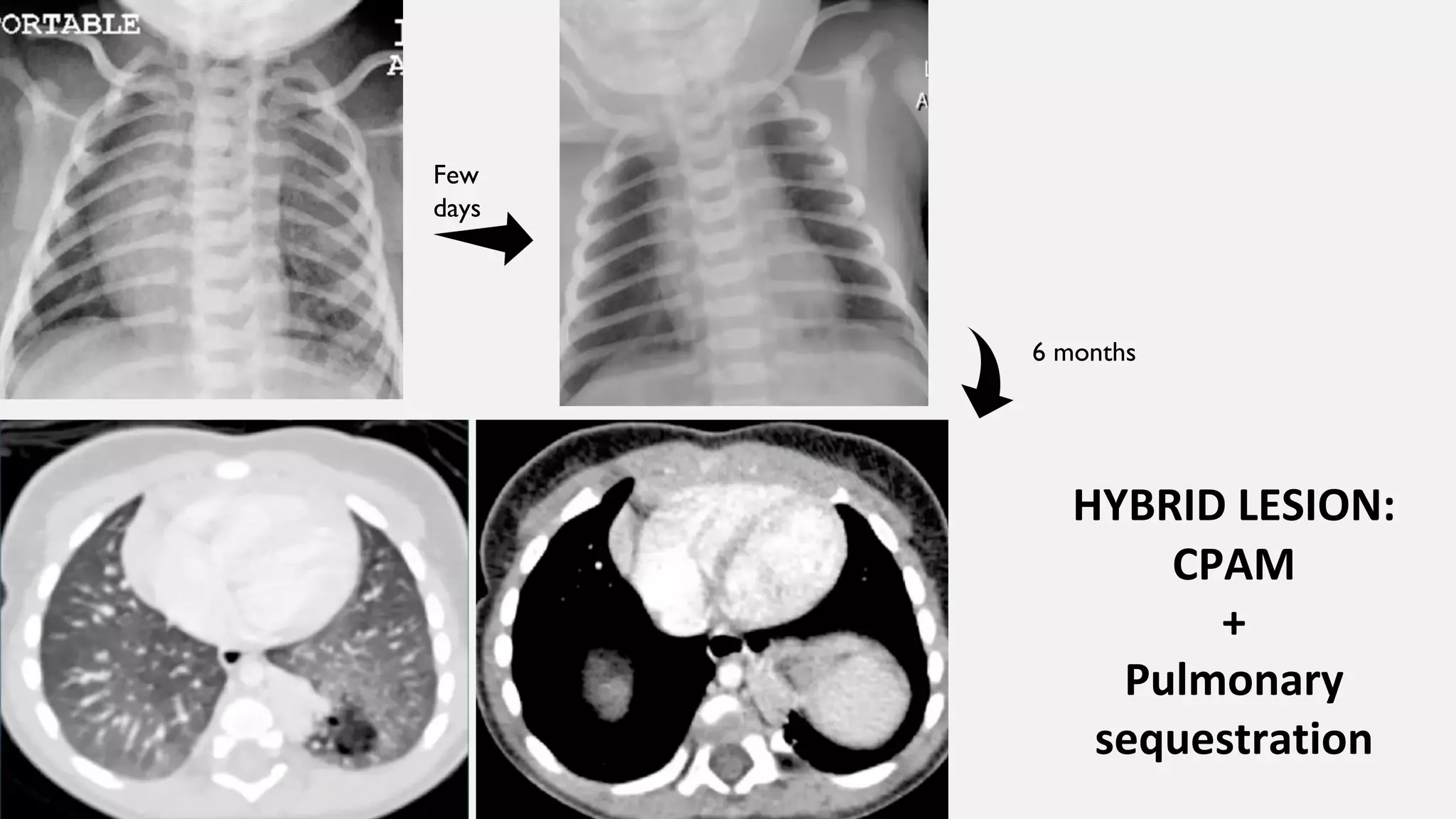 Paediatric chest 031220 | PDF