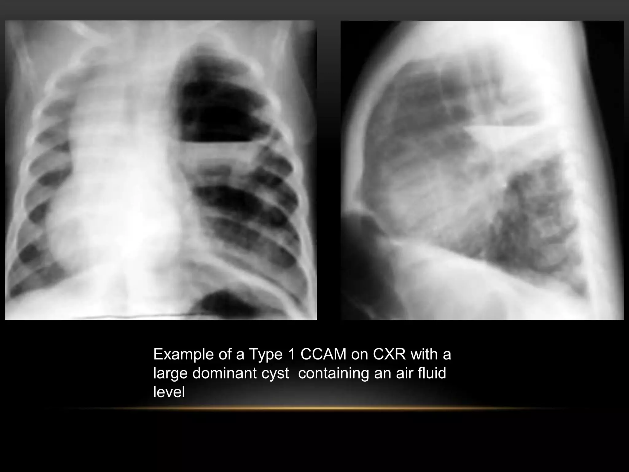 Paediatric chest imaging | PPTX
